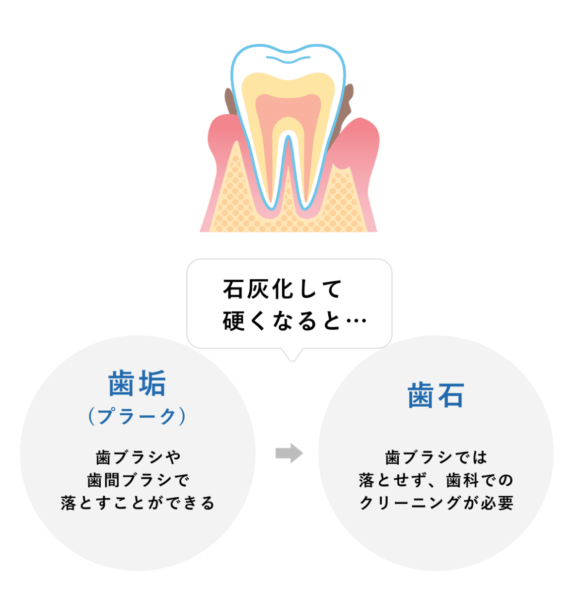 糖尿病が虫歯や歯周病の原因に！BMIが高い40代は歯を喪失しやすい！肥満と歯の研究【滋賀医科大学・森野准教授】 - Wellulu